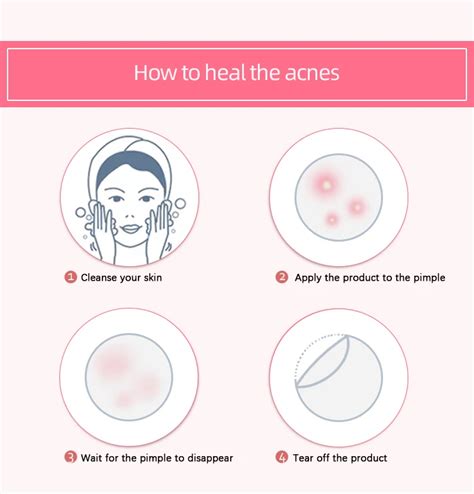 Large Pimple Patches 5 Sizes Big Acne Patches Xl Hydrocolloid Bandages