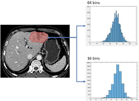 Figure 1 From Radiomics Applications In Primary Liver Cancer Semantic Scholar