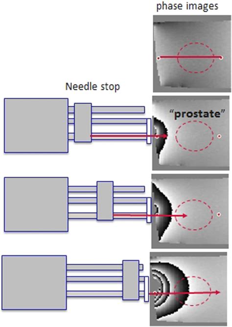 Measurements Of Magnetic Field Perturbation Due To The Implant Device Download Scientific