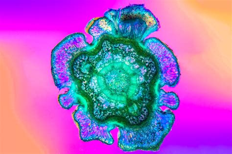 Honorable Mention Robert Berdan 顯微觀點