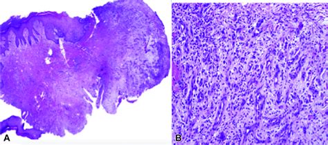 Histology A The Gross Tissue Specimen And B A Zoomed In View Of
