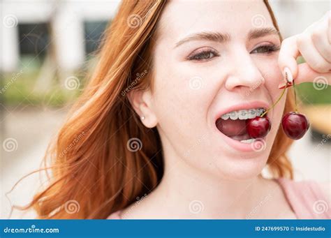 Beautiful Young Red Haired Woman With Braces On Her Teeth Eats Sweet