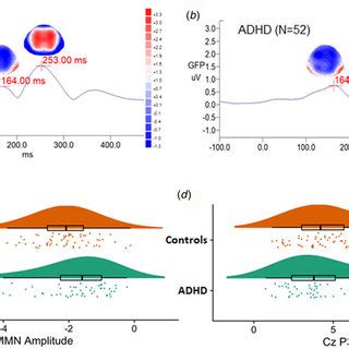A Magnified Version Of Fig C Grand Average MMN P A Waveforms Showing Download Scientific