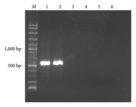 The Sensitivity Test Of Pcr A Lamp B Qpcr C And Qlamp D