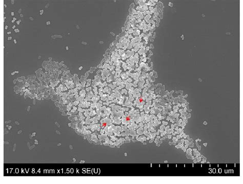 Scanning Electron Microscopy Image Of A Staphylococcus Aureus Download Scientific Diagram