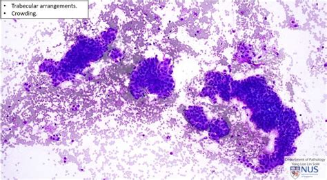 Thyroid Cytoweb Practical Cytopathology
