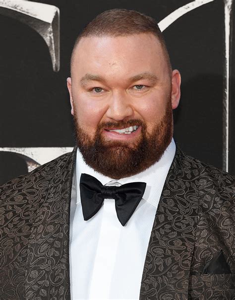 Thor Bjornsson Hair Loss Journey Vinci Hair Clinic
