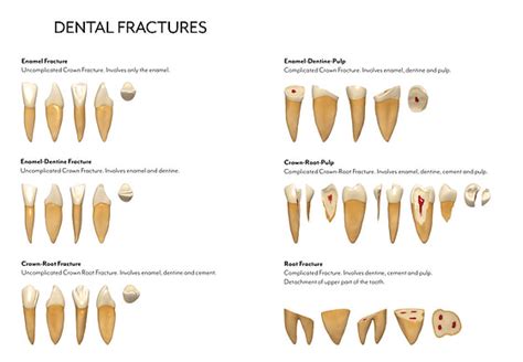 Pakistan Association Of Legal Dentistry A Classification Of Dental