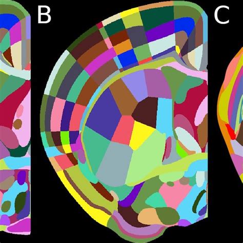 Scalable Brain Atlas Allen Mouse Brain Common Coordin