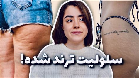 فوبیایِ سلولیت دیگه تموم شدهواقعی Youtube