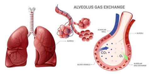 30 Cystic Fibrosis Breathing Stock Illustrations Royalty Free Vector