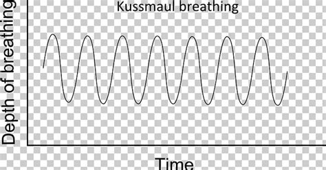 Kussmaul Breathing Kussmauls Sign Respiration Respiratory System Png