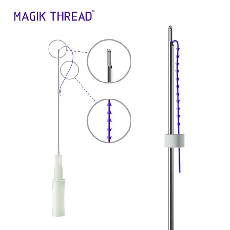 Pdo Cog Thread Online Sale Dermax