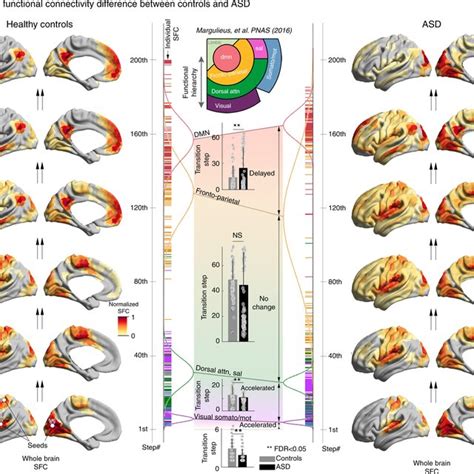 Connectome Gradient Mapping In Autism Spectrum Disorders Asd And