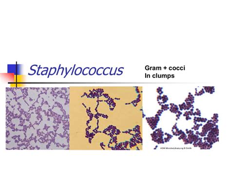Staphylococcus Identification S Aureus Epidermidis Saprophyticus