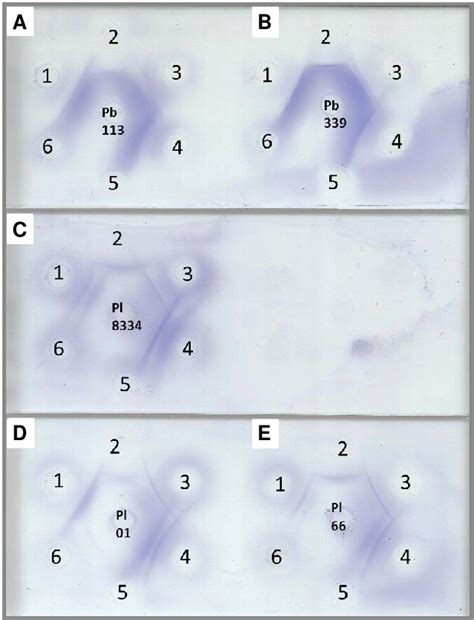 Double Immunodiffusion Assay With Different Paracoccidioides Spp