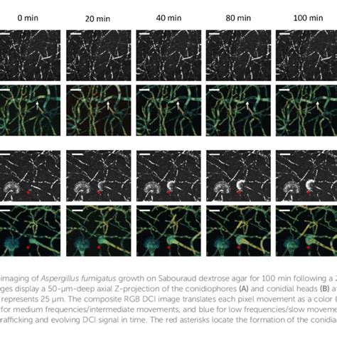 three dimensional ff and d oct imaging of aspergillus fumigatus growth