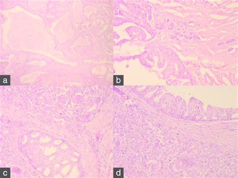 A Section Showing Intraductal Component Of The Salivary Duct Download Scientific Diagram