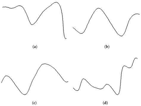 An Intrinsically Explainable Method To Decode P300 Waveforms From Eeg Signal Plots Based On