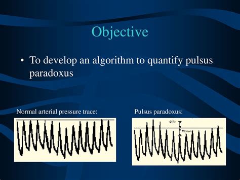 Quantifying Pulsus Paradoxus Ppt Download