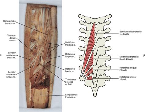 Muscles That Influence The Spine Basicmedical Key