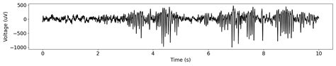 Time Frequency Analysis — Neurodsp 2 3 0 Documentation
