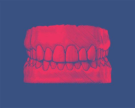 Gingivitis Drawing Illustrations Royalty Free Vector Graphics And Clip