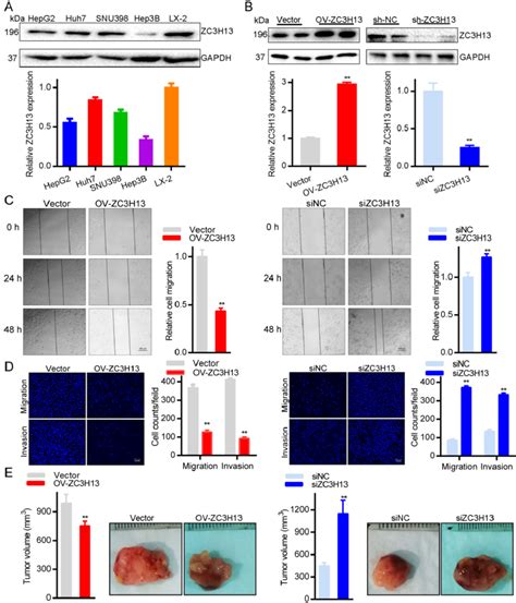 Upregulating Zc3h13 Inhibited The Aggressive Behaviors Of Hcc Cells
