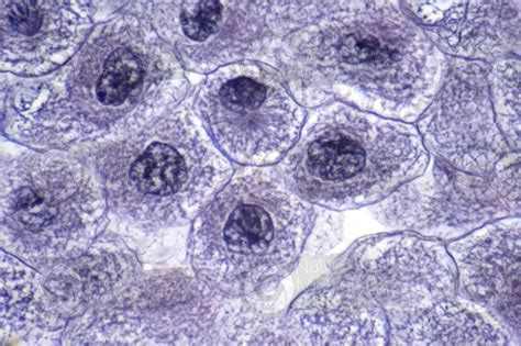 Interphase Under Microscope