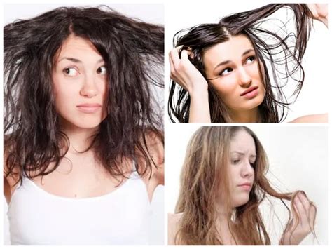 Beragam Tips Mengatasi Rambut Lepek Simak Cara Mengatasinya