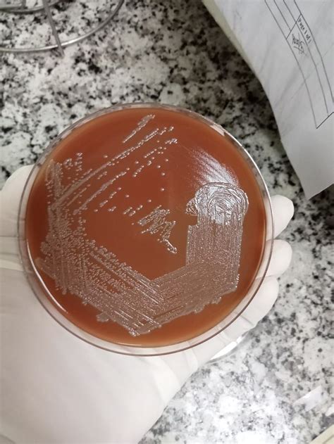 Enterococcus Faecalis 29212 On Chocolate Agar Medium Microbiology