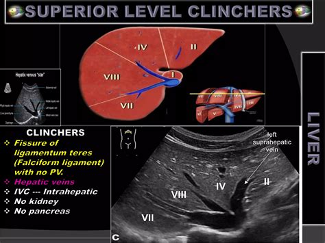 Liver Segmental Anatomy Pdf