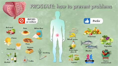 Prostate How To Prevent Problems Elisirlife Blog And News About