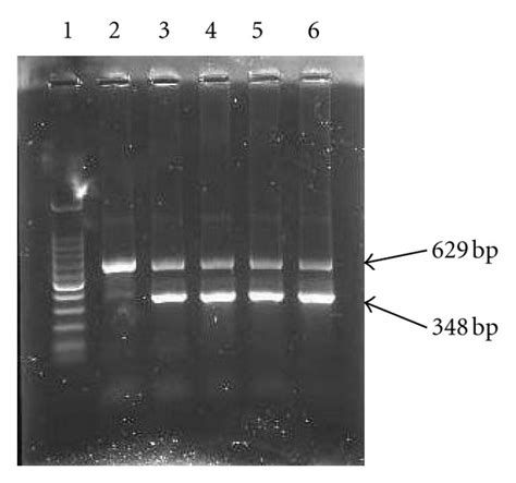 Specific Sequence Primer Polymerase Chain Reaction Ssp Pcr Analysis