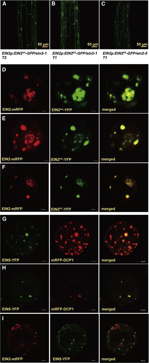 Subcellular Localization Of Ein2 Variants Download Scientific Diagram