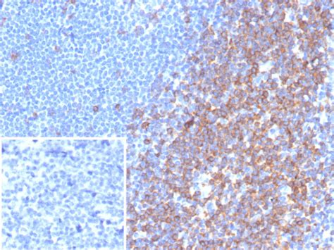 Cd7 T Cell Leukemia Marker Monoclonal Antibody Rcd7 6972 924 Msm12 P1abx