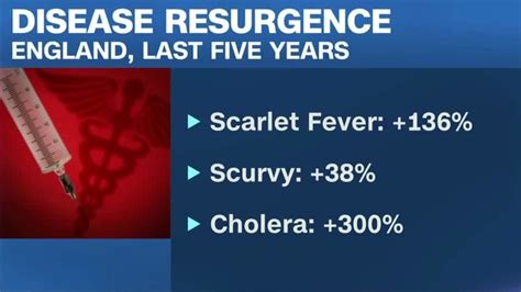 ‘victorian Diseases Like Scurvy Tb Rebound In Uk Cnn