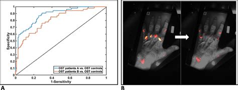 A B Diagnostic Performance Of Optical Spectral Transmission A
