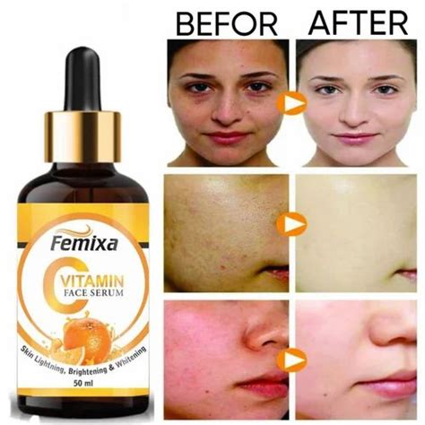 Fexima Vitamin C Face Serum At ₹ 30bottle स्किन सिरम In Surat Id