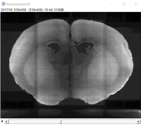 registration accuracy image analysis image sc forum