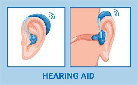 Ear Hearing Aid Device Symbol Set Illustration Vector Vector Art At Vecteezy
