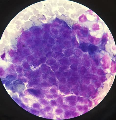 Laboratory Diagnostics Microscopy Pikabumonster