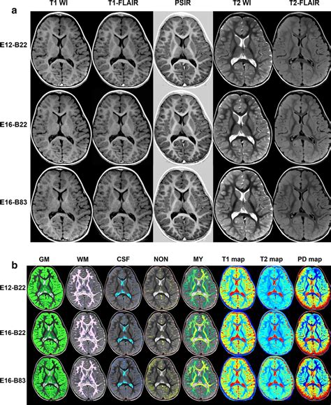 representative contrast weighted images quantification maps and tissue