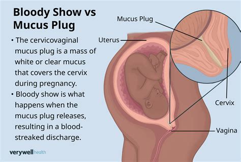 Your Cervix In Early Pregnancy Preterm Birth Clinic Milton Keynes