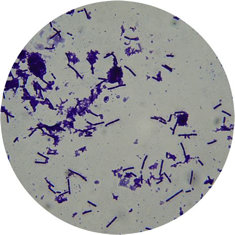 Lactobacillus In Yogurt Light Microscope Lactobacillus In Yogurt Light Microscope