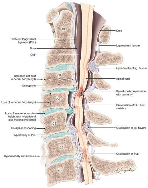 Cervical Spine Pathologies In Single Neurosurgery Kth