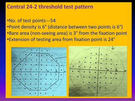 Visual Field Analysis Interpretation Pptx