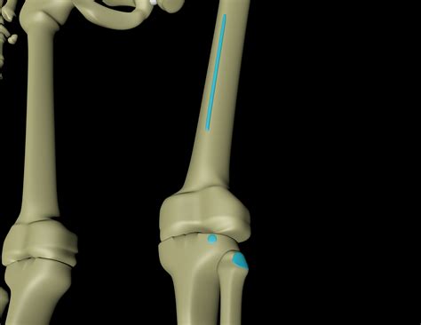 Biceps Femoris Myoreflex