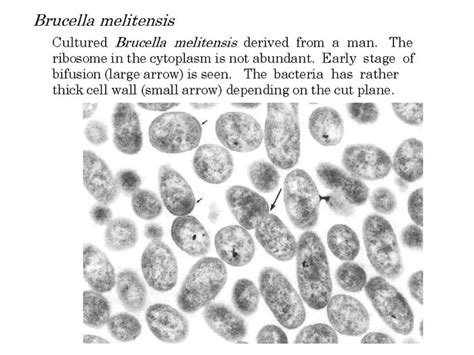 Brucella Melitensis Meddic