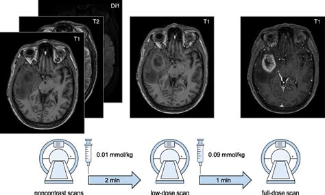 Reduction Of Gadolinium Based Contrast Agents In Mri Using C Investigative Radiology